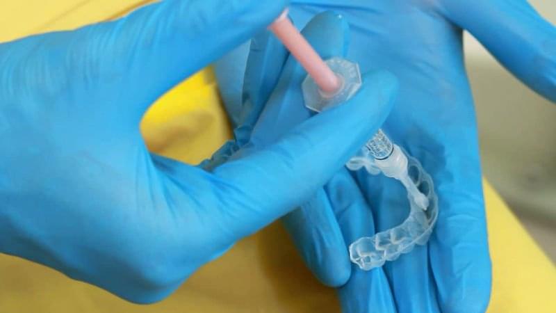 Избелване на зъби в домашни условия